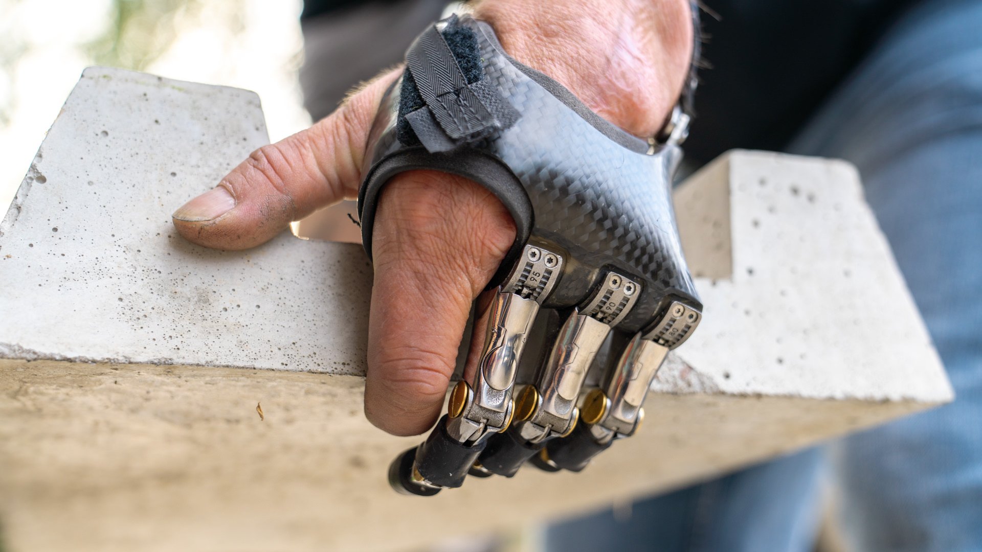 Finger and Partial Hand Prosthetic Options | Arm Dynamics